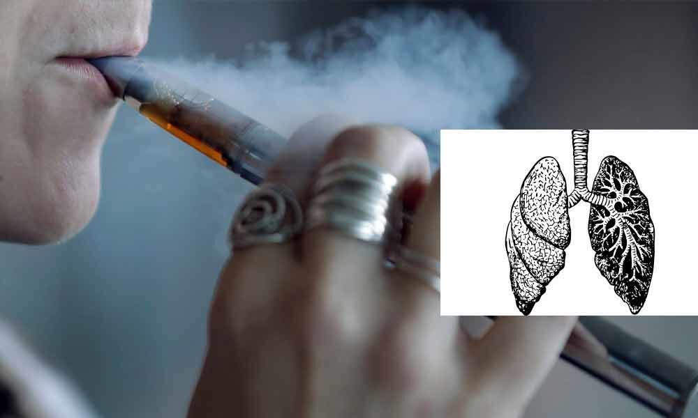 US: Researchers discover why vaping causes lung related illnesses