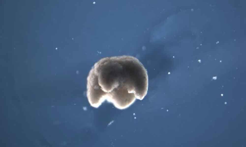 Xenobot: World's First Living, Self-healing Robots Using Frog Stem Cells