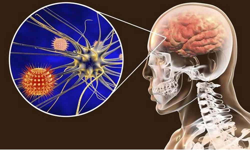 COVID-19 infection can have impact on brain function