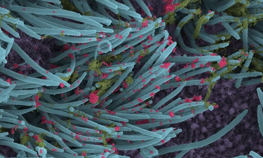 Biocon to make antibody for Covid treatment