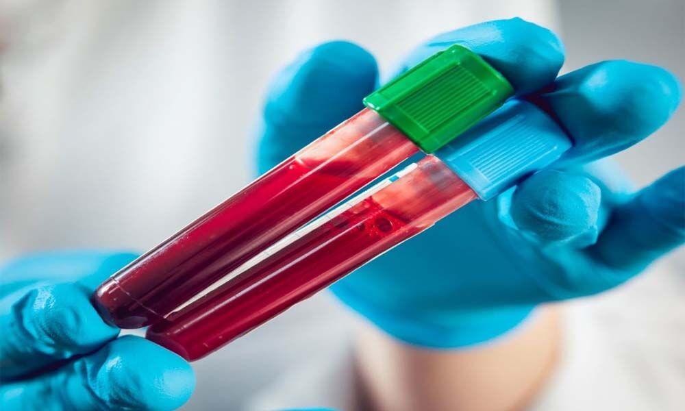 Scientists find drug cocktail effective against Delta, Beta variants