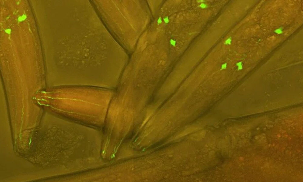 Scientists Used Pieces From Hydra To Rearrange The Brain Of Mutant Worm
