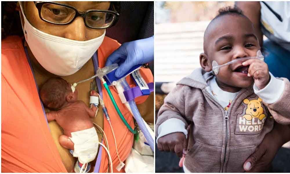 World's Most Premature Baby Holds The New Guinness World Record For ...