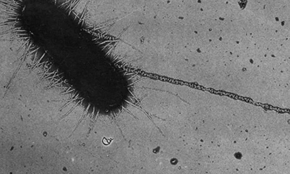 Researchers Discovered More About The Bacterial Bump-And-Grind