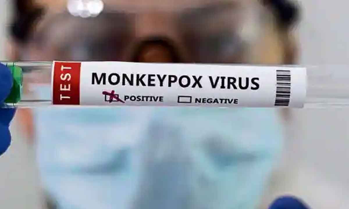 Monkeypox declared a public health emergency in New York City