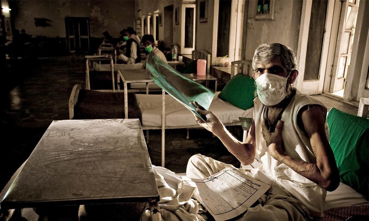 TB on rise for first time in decades