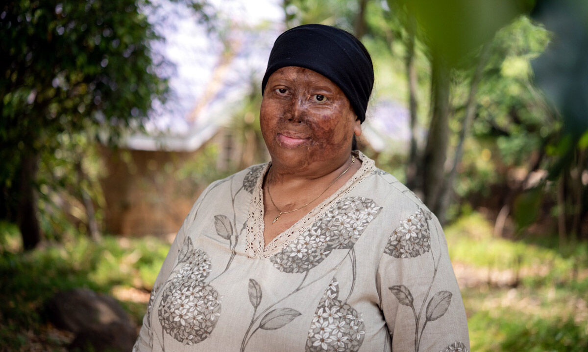 Denied a bank account, a brave acid attack survivor reaches out to Shah ...