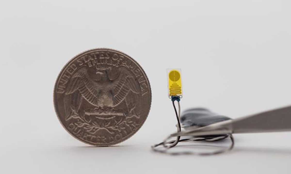 Novel device to monitor transplanted organs for early signs of rejection