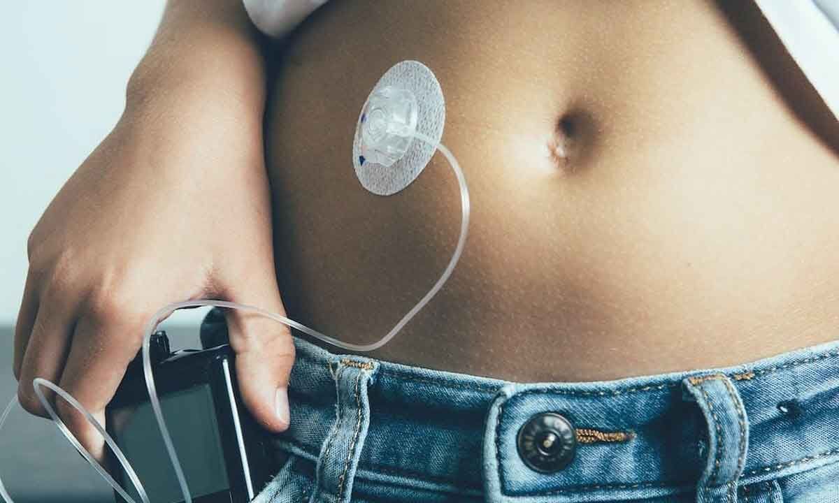 Stopping immune attacks key to make biomedical implants safer