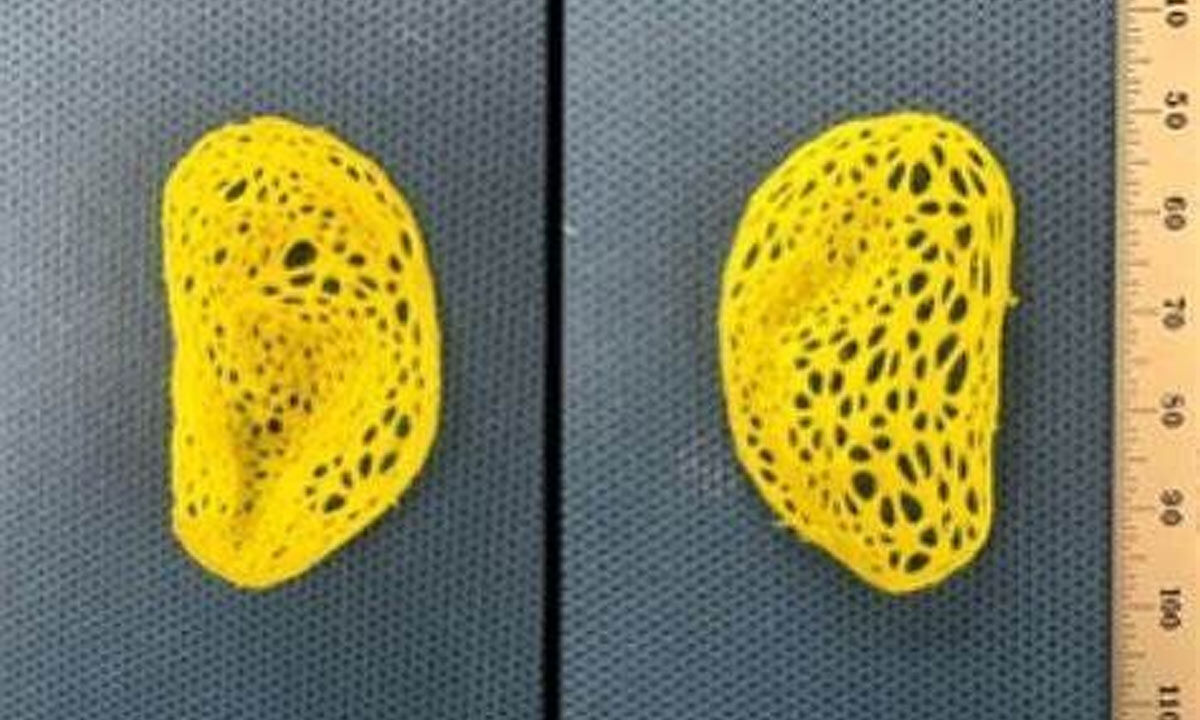 Scientists create replica of human ear that looks & feels natural