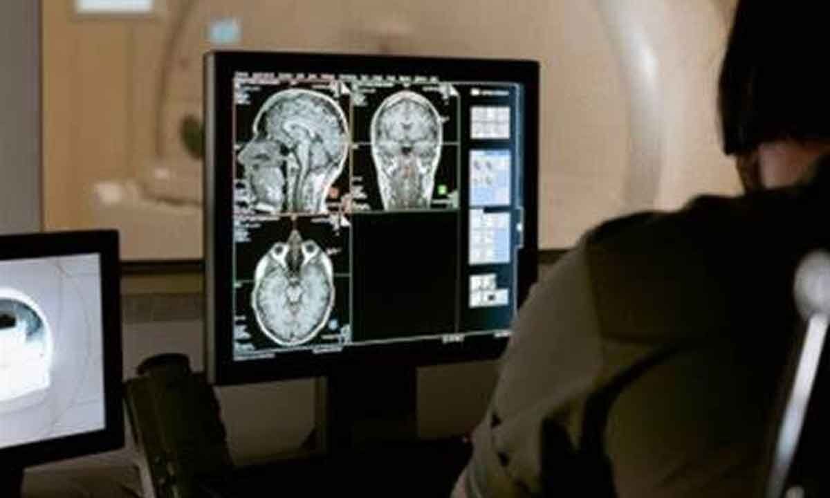 How brain scans can give distorted readings in some people
