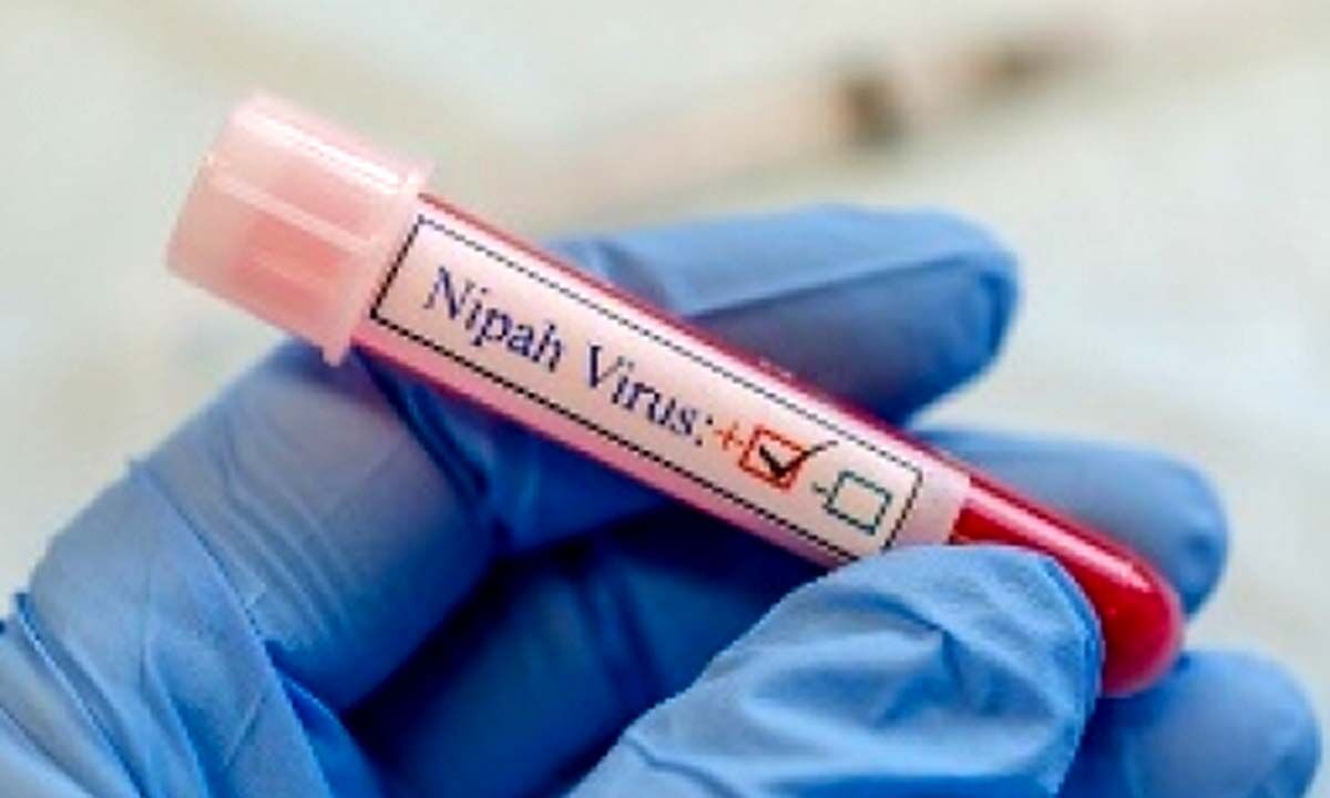 Nipah monoclonal antibody to undergo human trials in India, Bangladesh ...