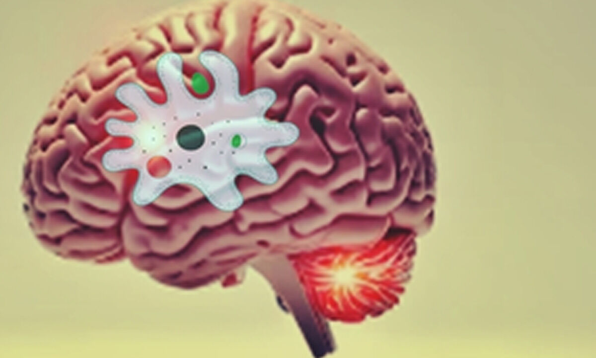 Monsoons may trigger brain infections in Indians living in coastal ...