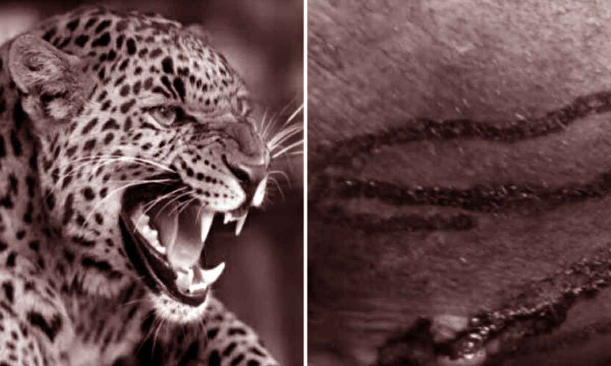 Farmer Injured in Leopard Attack
