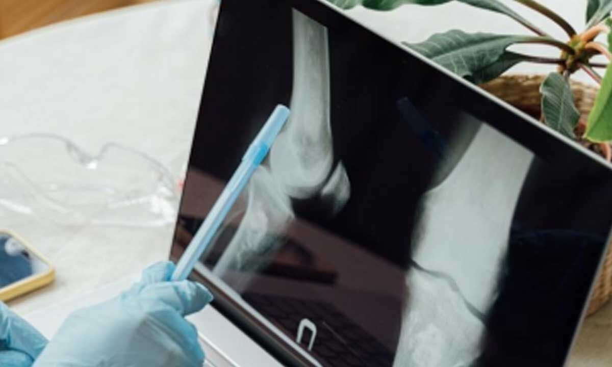 NIT Rourkela’s natural bioink to help 3D bioprinting of bone tissue