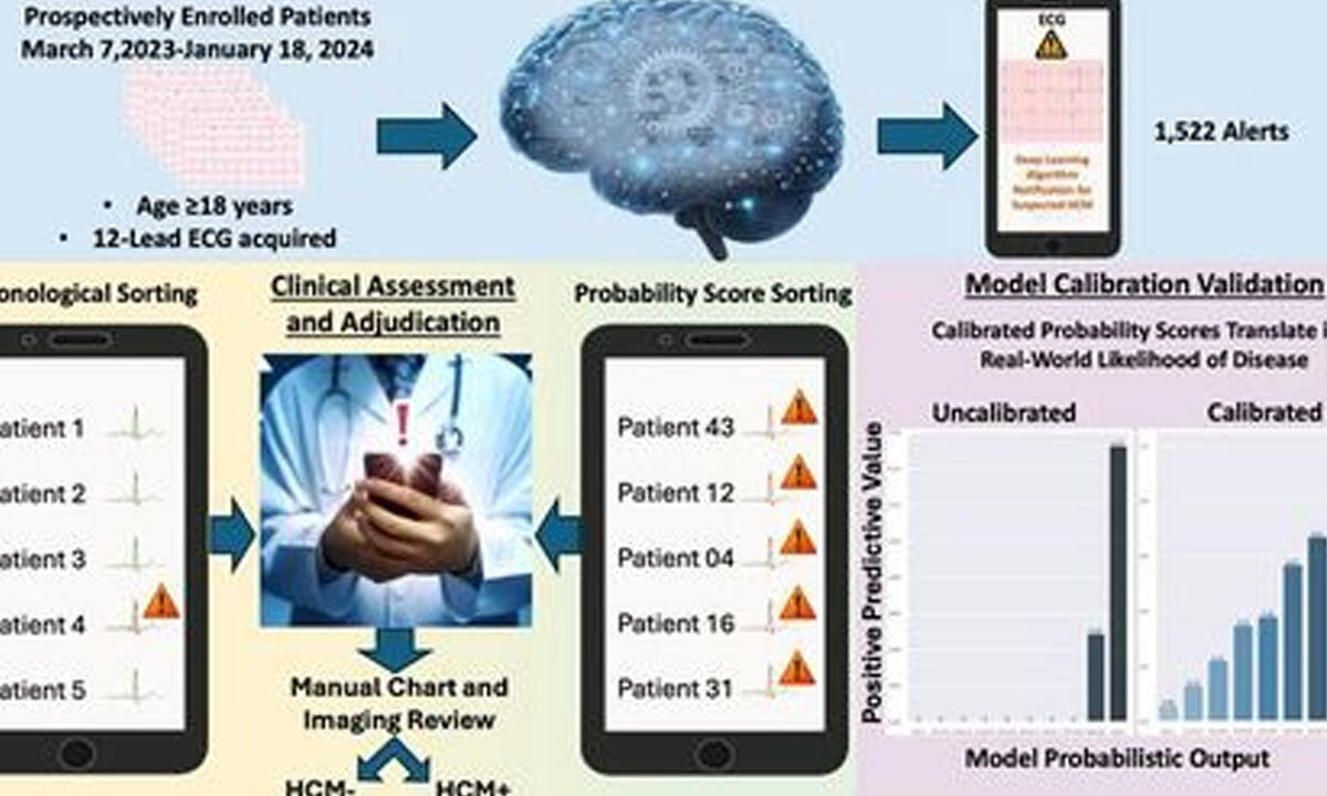 AI algorithm can help identify high-risk heart patients: Study