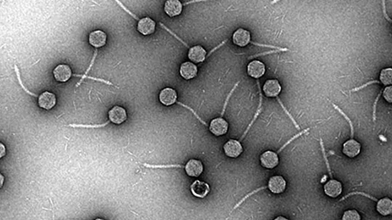 Hidden virus found common in germs that cause pneumonia: Study