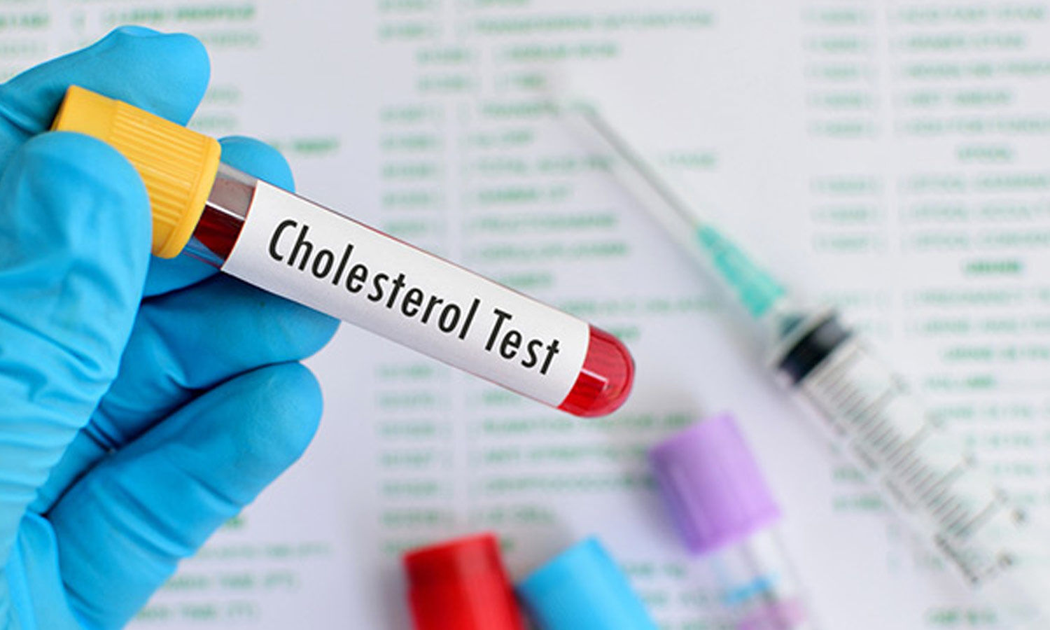 Why Everyone Needs a Cholesterol Check, Know Your Target Levels & What ...