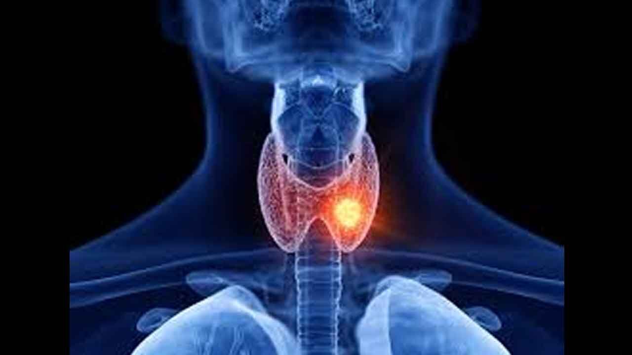 Minimally invasive procedure cures rare thyroid disorder without scars