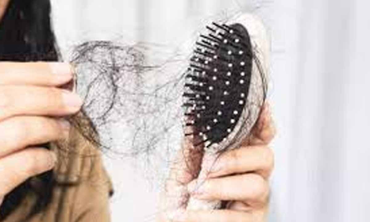 Seasonal Shedding Or A Warning Sign? The Truth Behind Winter Hair Fall