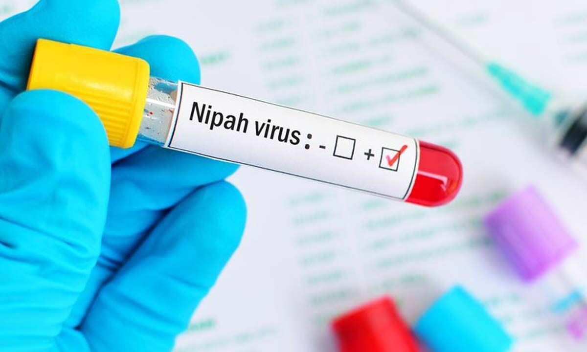 As Bengal logs Nipah cases, doctors advise people not to panic ...