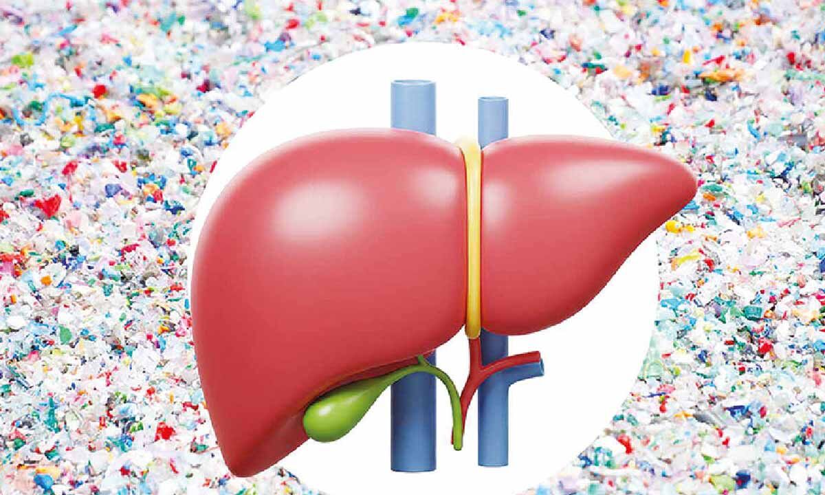 Microplastics threat: Scientists warn of rising link to liver disease