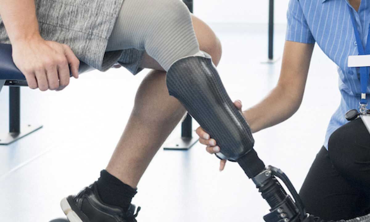 Free artificial limbs distributed to 90 persons